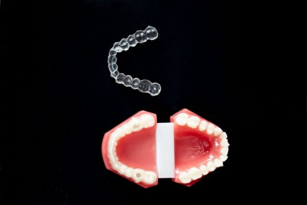 Teeth Chattering: What Your Body is Trying to Tell You - Discover the ...