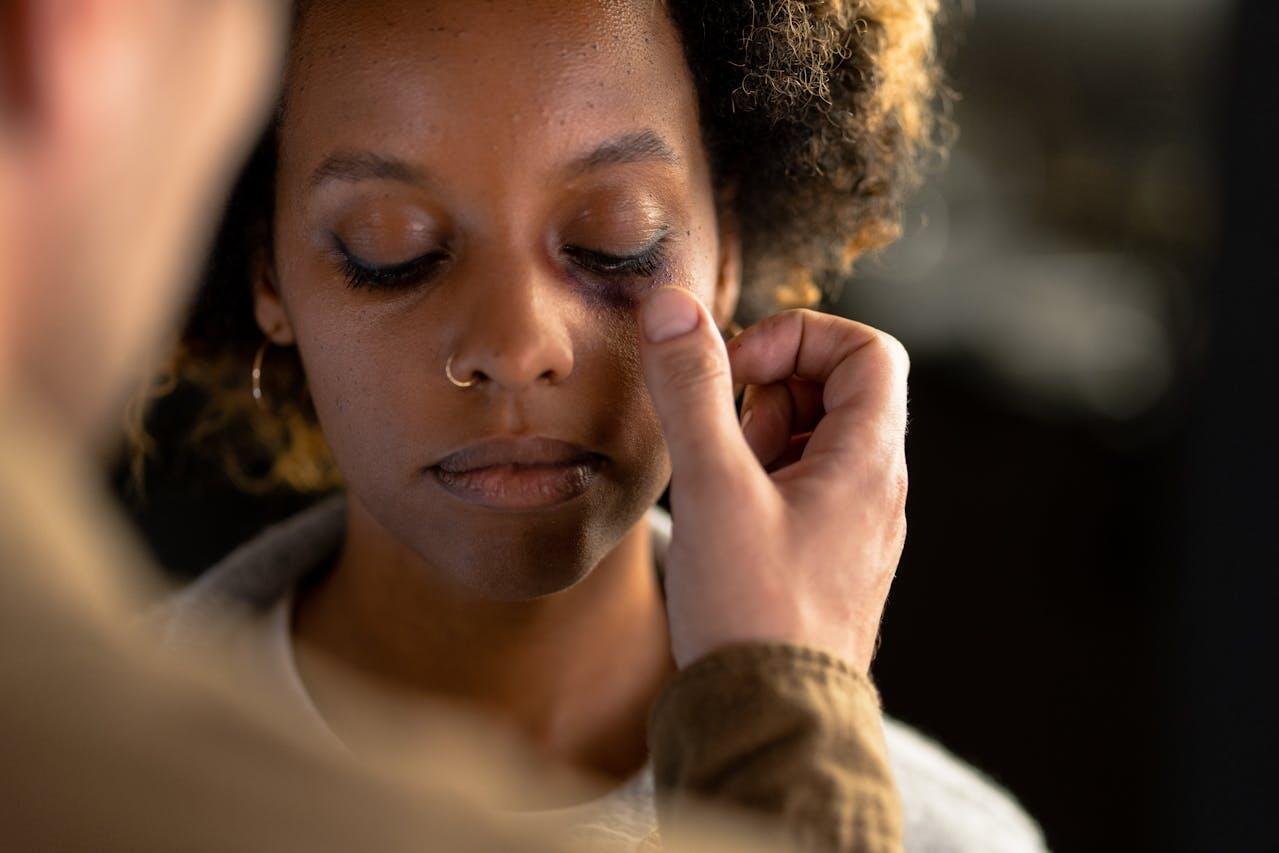 Emergency first aid for common eye injuries - Discover the Cure Within